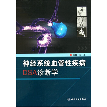 神经系统血管性疾病DSA诊断学