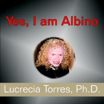 【】Yes, I Am Albino