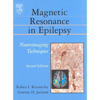 【】Magnetic Resonance in Epilepsy: