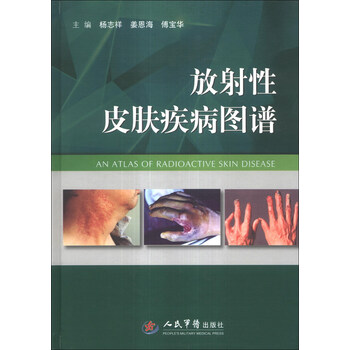 正版 放射性皮肤疾病图谱9787509169322