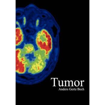 【】Tumor