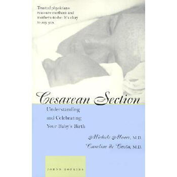 Cesarean Section: Understanding and Celebrat...
