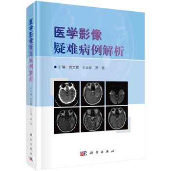 医学影像疑难病例解析 贾文霄 王云玲 邢艳 9787030713582 科学出版社