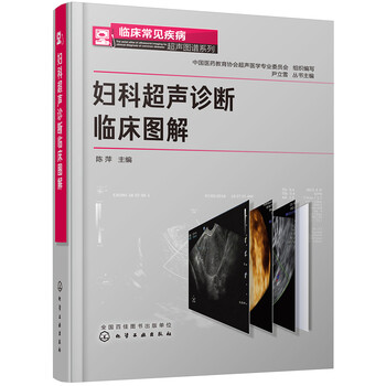 临床常见疾病超声图谱系列--妇科超声诊断临床图解