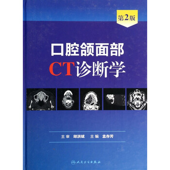 口腔颌面部CT诊断学(第2版)(精)