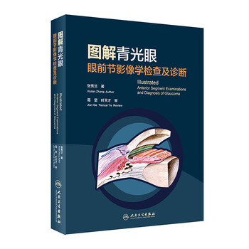 图解青光眼   眼前节影像学检查及诊断