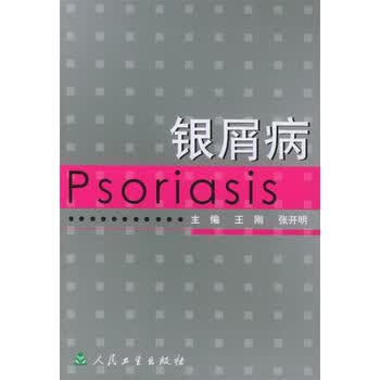 银屑病 王刚 等主编【正版书】