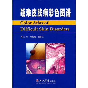疑难皮肤病彩色图谱 朱文元,倪容之 主编【正版书】