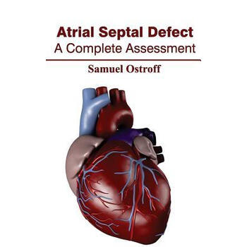 Atrial Septal Defect: A Complete Assessment