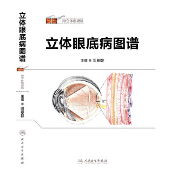 立体眼底病图谱