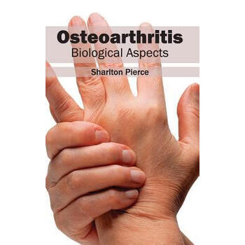 Osteoarthritis: Biological Aspects