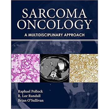 Sarcoma Oncology                                