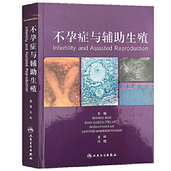 不孕症与辅助生殖