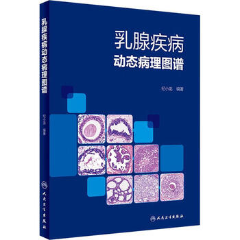 乳腺疾病动态病理图谱 纪小龙 著 妇产科 
