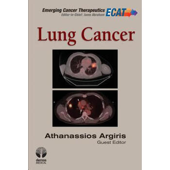 高被引Lung Cancer