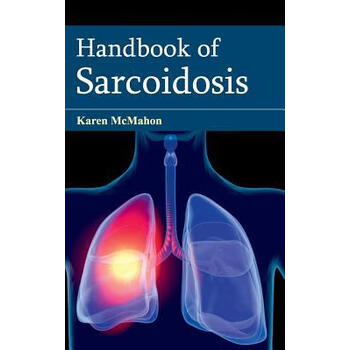 Handbook of Sarcoidosis