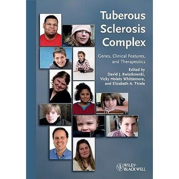 高被引Tuberous Sclerosis Complex: Genes, Clinical