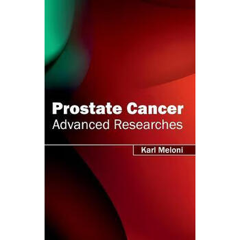 Prostate Cancer: Advanced Researches