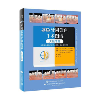 3D牙周美容手术图谱(天然牙篇)(精)