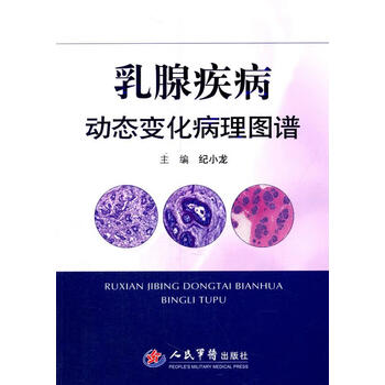 乳腺疾病动态变化病理图谱