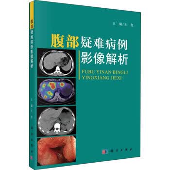 腹部疑难病例影像解析 王红 科学出版社