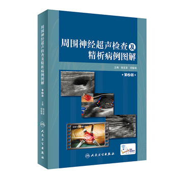 周围神经超声检查及精析病例图解(第2版)(精)