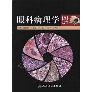 眼科病理学图谱 赵桂秋等编 人民卫生出版社