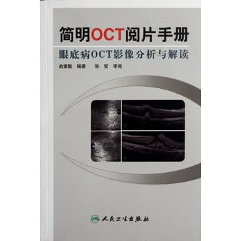 简明OCT阅片手册(眼底病OCT影像分析与解读)