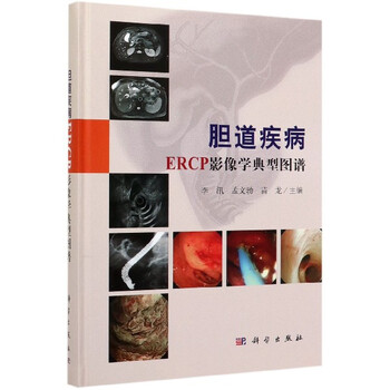 胆道疾病ERCP影像学典型图谱(精)