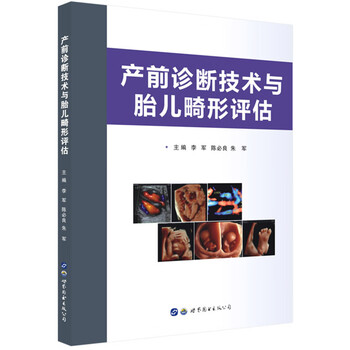 产前诊断技术与胎儿畸形评估