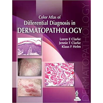 Color Atlas of Differential Diagnosis in Dermato