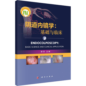 阴道内镜学:基础与临床