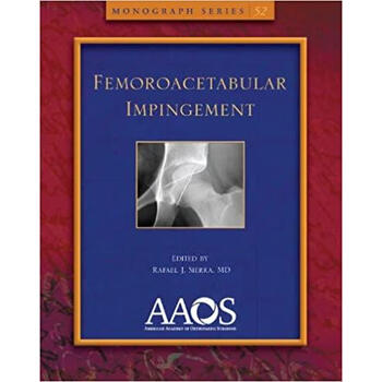 Femoroacetabular Impingement