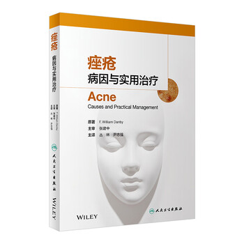 痤疮：病因与实用治疗