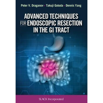 Advanced Techniques for Endoscopic Resection in