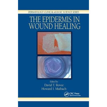 The Epidermis in Wound Healing