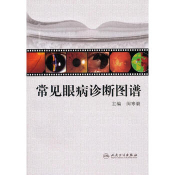 常见眼病诊断图谱 闵寒毅　主编【正版书】