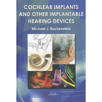 Cochlear Implants and Other Implantable Hearing