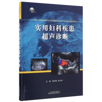实用妇科疾患超声诊断(附光盘)(精)