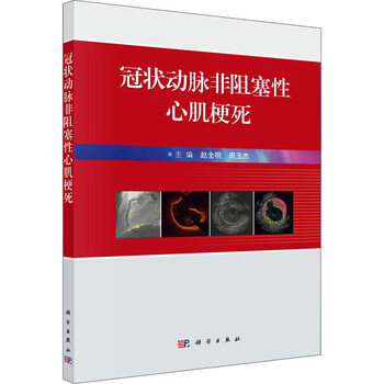 冠状动脉非阻塞性心肌梗死