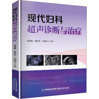 现代妇科超声诊断与治疗 图书