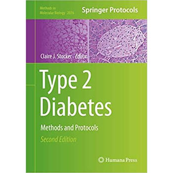Type 2 Diabetes: Methods and Protocols