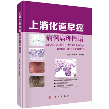 上消化道早癌病例病理图谱 李玉民 黄晓俊