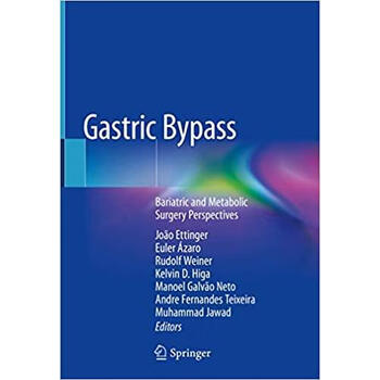 Gastric Bypass: Bariatric and Metabolic Surgery 