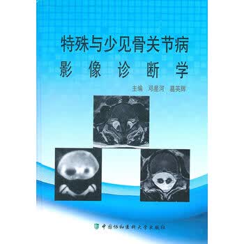特殊与少见骨关节病影像诊断学【正版图书】