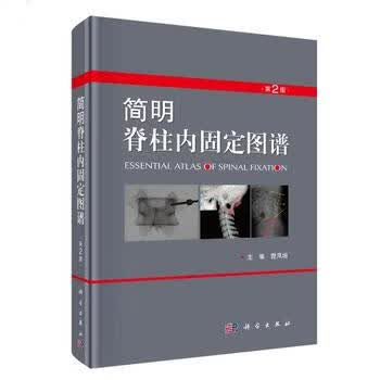 简明脊柱内固定图谱(第2版)