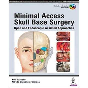 Minimal Access Skull Base Surgery: Open and Endo