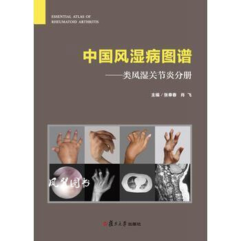 中国风湿病图谱  类风湿关节炎分册 张奉春，肖飞 复旦大学出版社