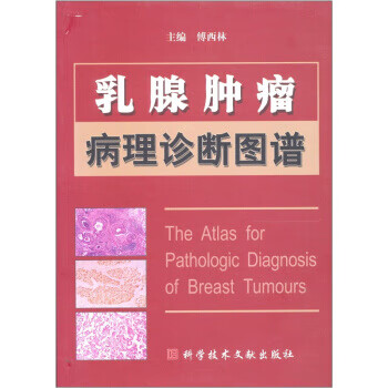 乳腺肿瘤病理诊断图谱【正版图书】