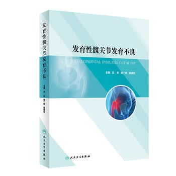发育性髋关节发育不良